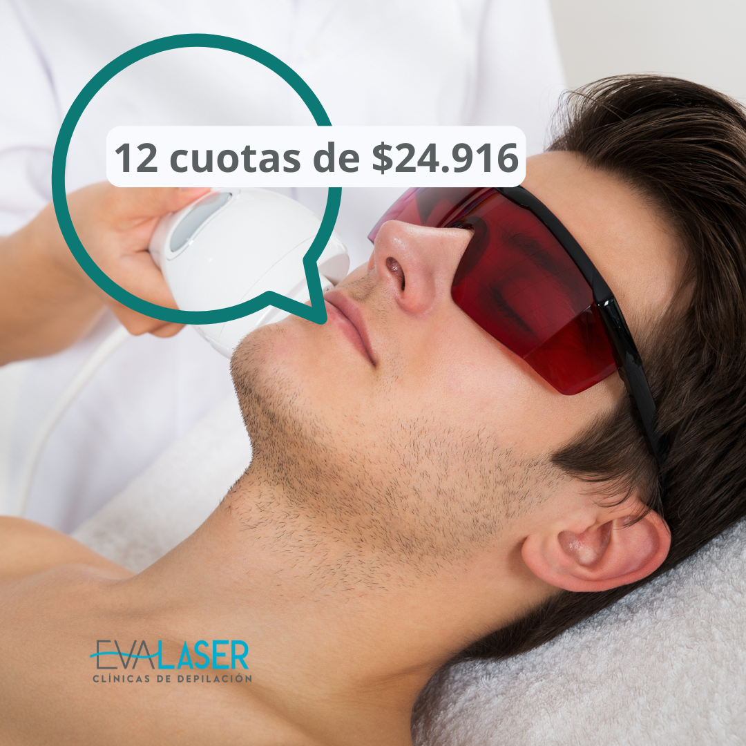 Barba Completa – Evalaser