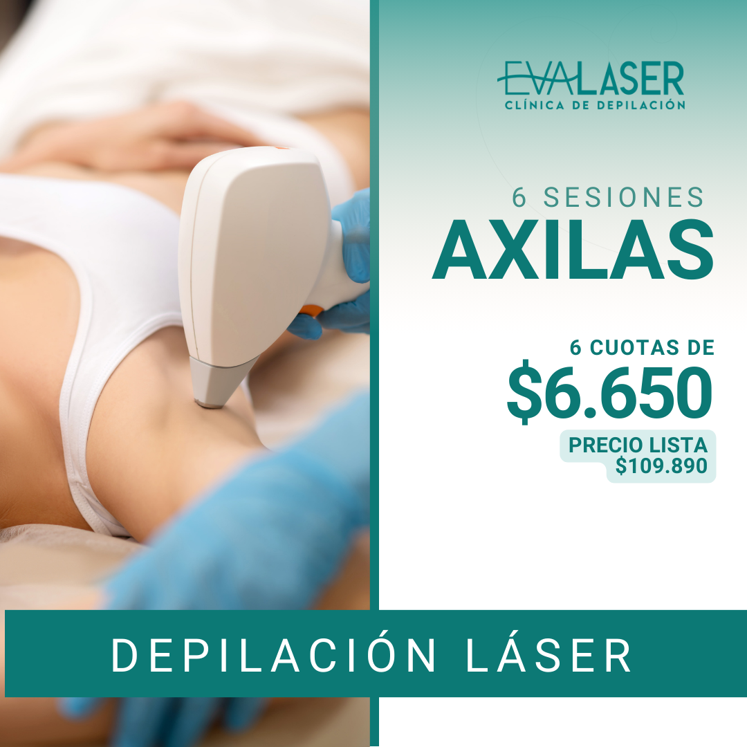 Depilacion Láser en Axilas – Evalaser